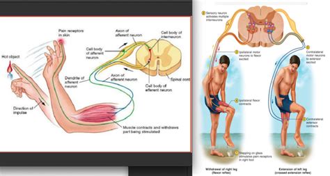 Crossed Extension Reflex