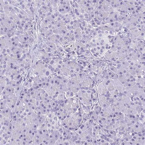 Rabbit Polyclonal Anti Gfap Antibody Buy For Research Highly