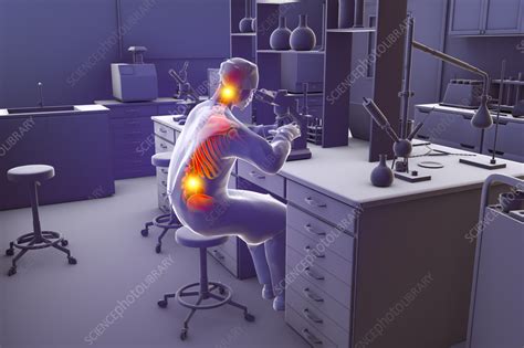 Musculoskeletal Disorders Caused By Computer Use At Kathy Foley Blog