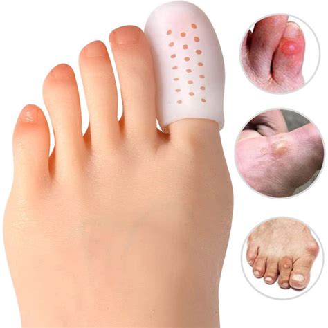 Big Toe Capsbreathable Toe Cushions With Holes Wish