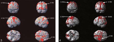 Surface Rendered Activation In A Representative Female Subject Download Scientific Diagram