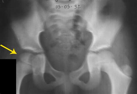 Bibliographic References Oncosurgery