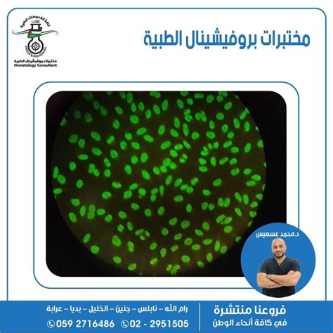 Dr Mohammad Asees On Linkedin Strong Positive Ana Test With