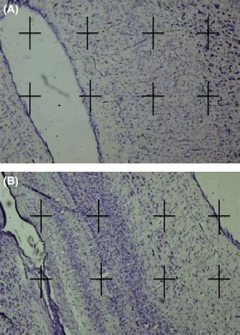 A And B Histological Views With Point Grid Overlaid Download