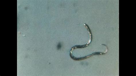 1970s Microscopic Worms Wriggle About Corn Stalks In Field Diagram Of Small Thin Roundworm