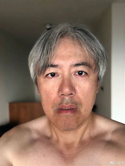 退圈2年，53岁张宇受遗传病困扰，近照已是满头白发专辑