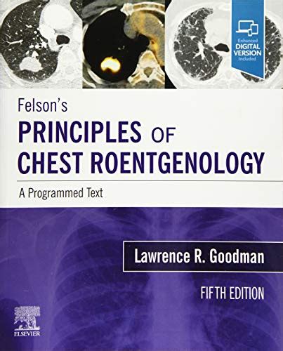 Top 10 Best Books To Learn Chest X Ray Themdjourney
