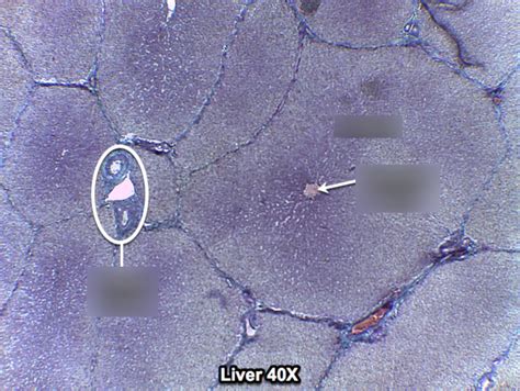 Liver Histology Diagram Quizlet