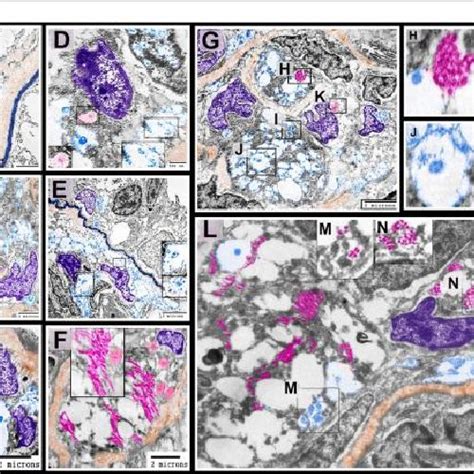 Mature And Immature Rodlet Cells In Skin Musculoskeletal