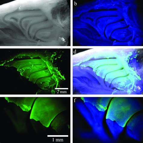 Direct Immunostaining On Ethmoid Turbinates The Morphology Of Whole