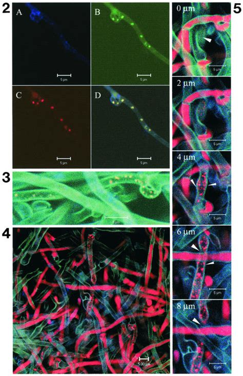 In Situ Identification Of Intracellular Bacteria Related To