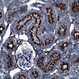 Mouse Aminopeptidase Ncd13 Antibody Af2335 By Randd Systems Part Of