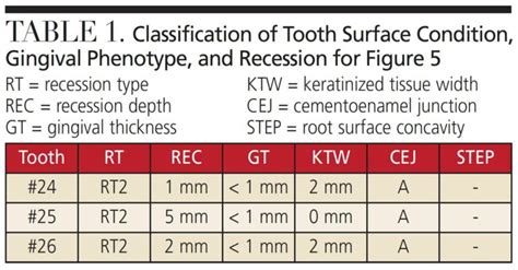 Decision Making In Modern Mucogingival Therapy Decisions In Dentistry