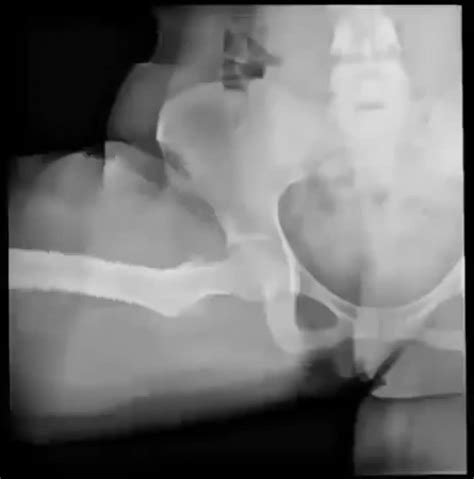 Shreenivas Murthy Posted On Linkedin