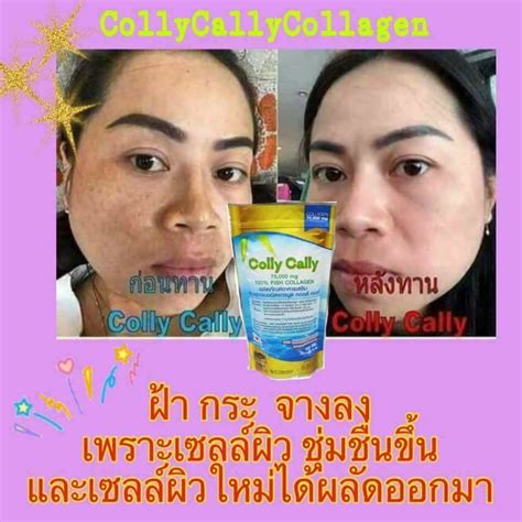 ฝ้า สิว หนักมากกก 😳😮 Colly Cally คอลลาเจน แท้100