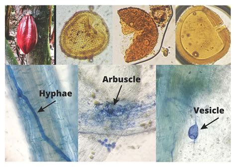 Arbuscular Mycorrhizal Fungi Microscope
