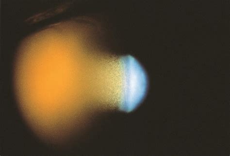 File Figure 10 Ghost Cell  Eyewiki