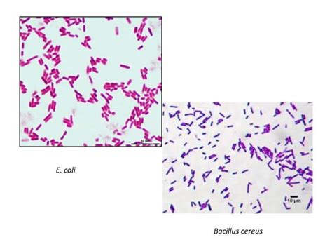 Microorganisms Under Microscope Pptx
