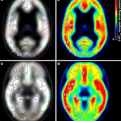 The Serotonin 1a Receptor 5 Ht 1a Binding Potential Download