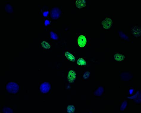 Cell Proliferation Assay Abp Biosciences
