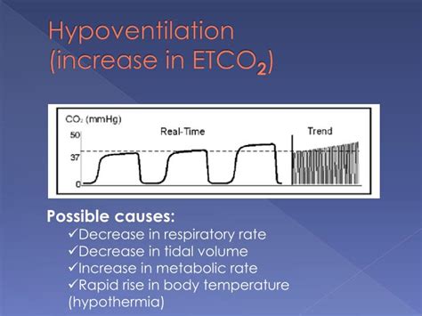 Ppt Capnography Powerpoint Presentation Id2237765