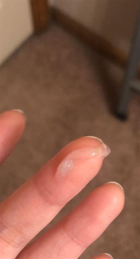 Why Does My Discharge Look Like This Its Clumpy And It Kind Of Came Why Does My Discharge Look Like This Its Clumpy And It Kind Of Came