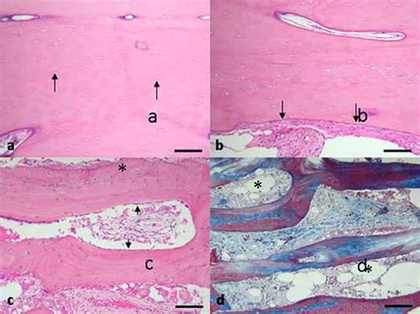 Allograft Block 9 Months A Bone Graft With Empty Osteocyte Lacunae Download Scientific