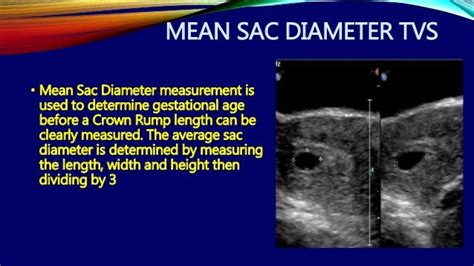First Trimester Ultrasound Dr Muhammad Bin Zulfiqar