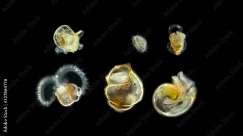 Larvae Of A Sea Snail Different Types Under The Microscope Called