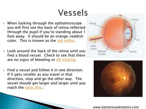 Ppt Basic Ocular Anatomy Powerpoint Presentation Free Download Id