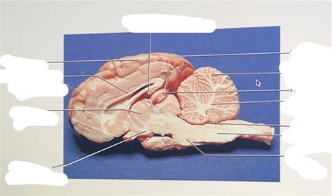 Sheep Brain Internal Diagram Quizlet