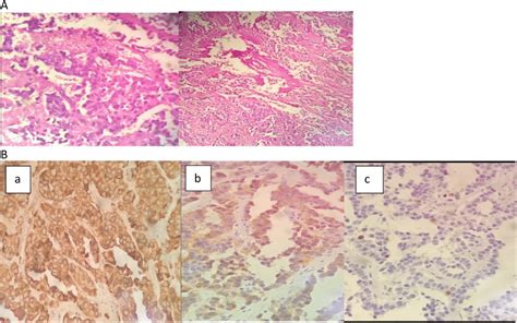 Anatomopathological Analysis Of The Specimen A Hematein Hematoxylin Download Scientific
