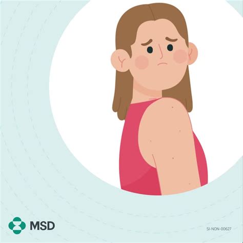 Msd Slovenija On Linkedin Si Non 00627video 2