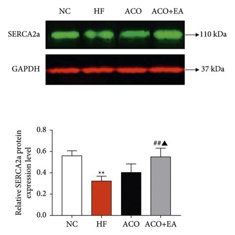 Relative Expression Of Serca2a Plb Ncx1 Protein In Left Ventricular