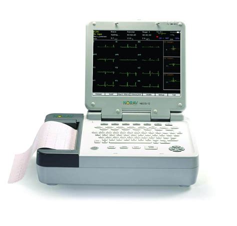 The Benefits Of Ecg Management Systems Vs Consultants Norav Medical