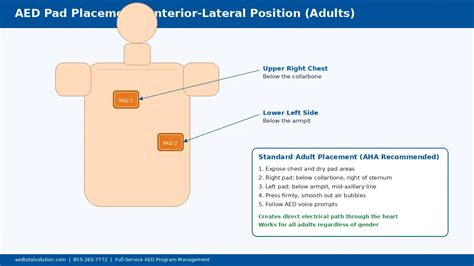 Aed Pad Placement Guide Where To Place Aed Pads Correctly Aed Total
