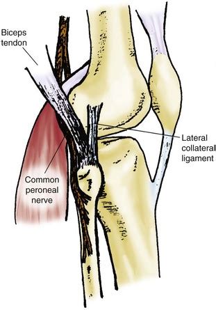 The Dislocated Knee Musculoskeletal Key