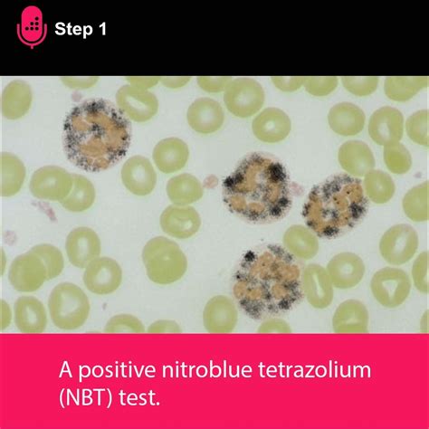 Medbullets Leukocyte Adhesion Deficiency Type 1 Lad 1