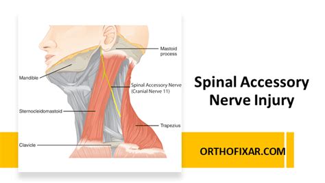 Surgical Anatomy Of The Spinal Accessory Nerve And The