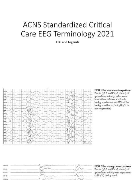 Acns Standardized Critical Care Eeg Examples 2021 Download Free Pdf