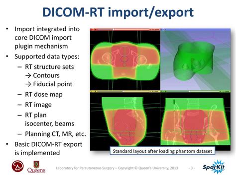 Improvements In Slicerrt The Radiation Therapy Research Toolkit For D Slicer Csaba Pinter