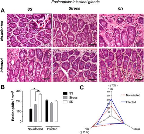 Periglandular Eosinophils In The Duodenum A Representative