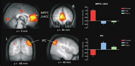 Brain Regions Showing Differential Activity As A Function Of Temporal Download Scientific