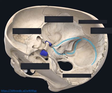 Groove For Sigmoid Sinus Content At Will Mcguirk Blog