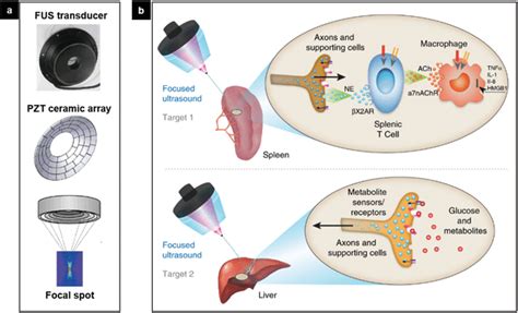 fus‐enabled neuromodulation a fus is constructed from concaved pzt