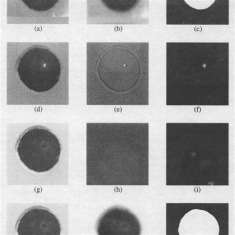 Series Of Images Showing Various Stages In Pupil Image Processing See Download Scientific