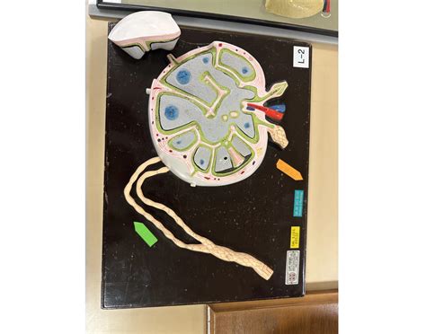 Lymph Node Quiz Lymph Node Quiz