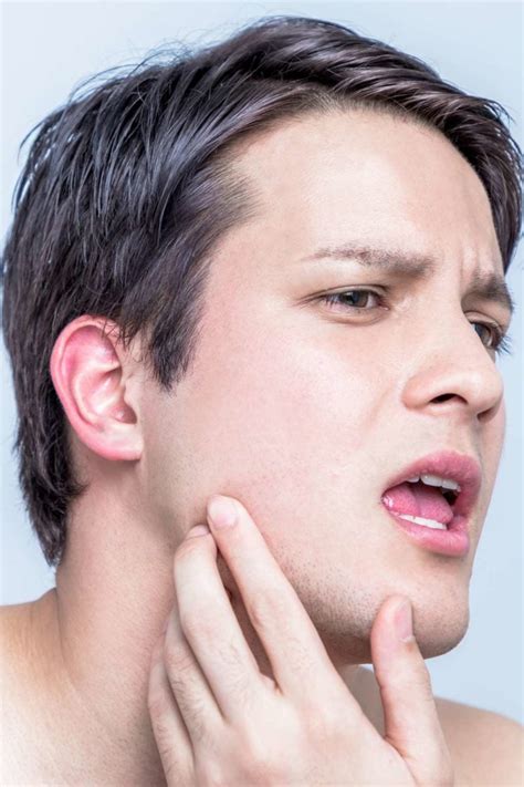 Flat Warts Identification Removal And Prevention