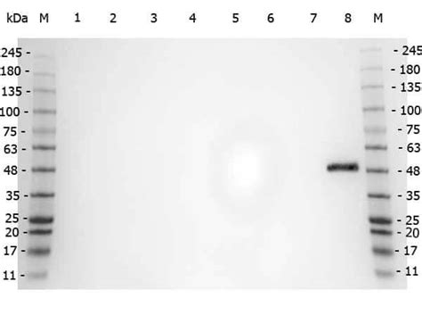 Ppar Alphanr1c1 Antibody N Terminal Bsa Free Nb600 636 Novus