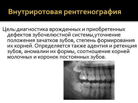 Телерентгенография - online presentation
